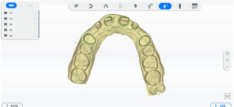 Modified Model Dentalscan