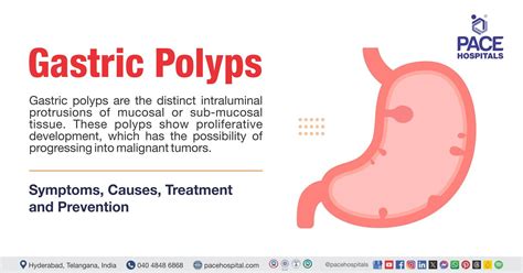 Hyperplastic Polyps Meaning
