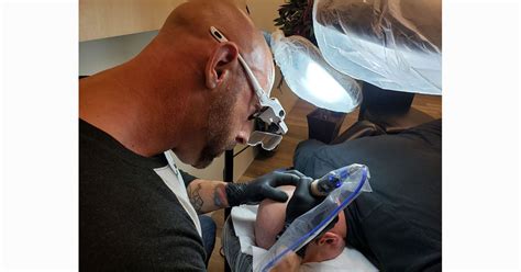 List Of Scalp Micropigmentation Tools And Equipment