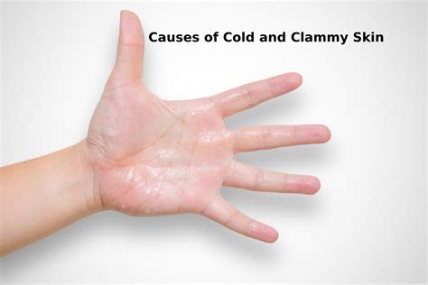 Causes Of Cold And Clammy Skin