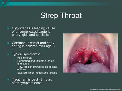 Streptococcus Bacteria In Throat