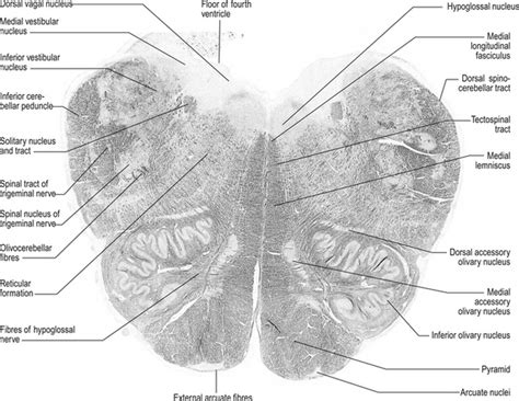 The Brainstem And Reticular Formation Clinical Gate