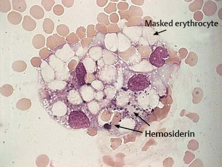 Cerebrospinal Fluid Analysis Neupsy Key