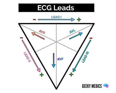 What Is Cardiac Axis ECG Interpretation Geeky Medics