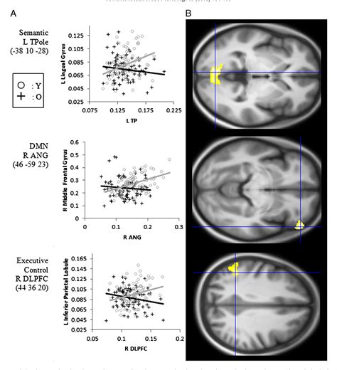 Figure 1 From The Impact Of Aging On Gray Matter Structural Covariance