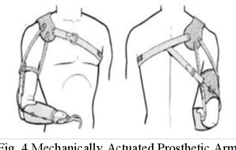 Figure 4 From Enhanced Framework For Active Prosthetic Arm Semantic