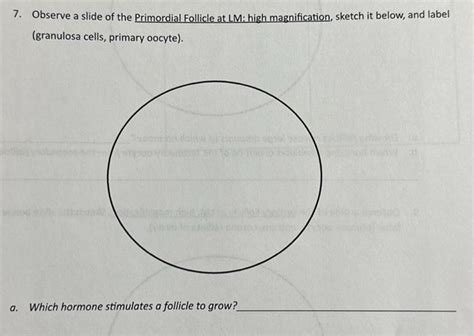 Solved 7 Observe A Slide Of The Primordial Follicle At