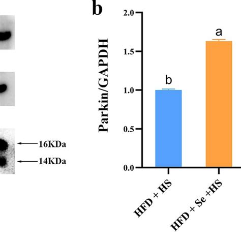 Effects Of Dietary Selenium On The Autophagy Pathway In The Liver Of
