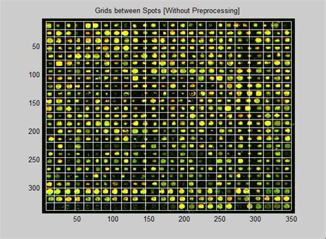 An Efficient Fully Automated Method For Gridding Microarray Images