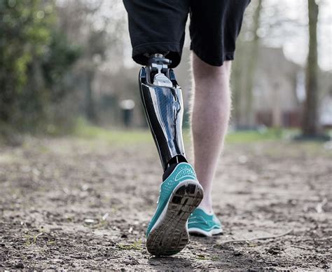 Advanced Lower Limb Prosthetics Services Provider In Bharatpur