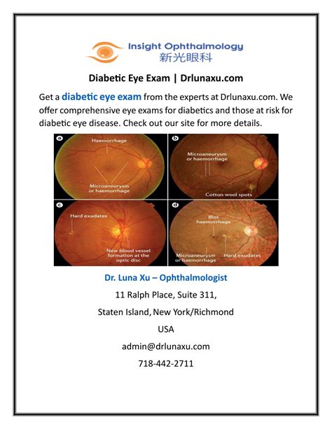 Ppt Diabetic Eye Exam Powerpoint Presentation Free