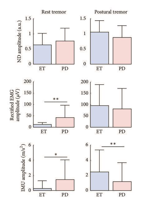A Average Amplitude Of The Rest And Postural Tremor In 54 Et And Pd Download Scientific