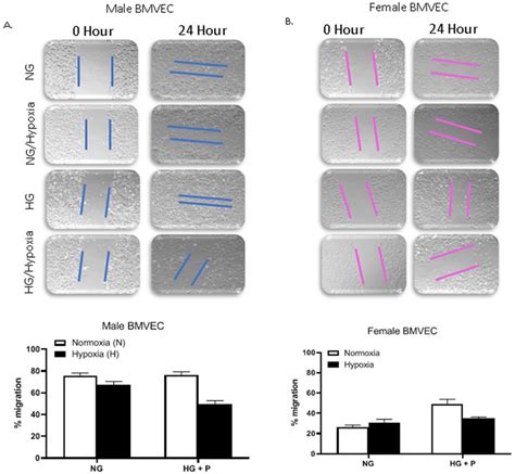Diabetes Related Sex Differences In The Brain Endothelin System Following Ischemia In Vivo And