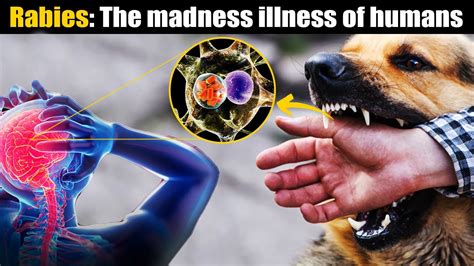 Rabies Virus A Documentary On Causes Symptoms And Prevention The