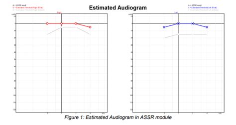 Eclipse Assr Hearing Test Interacoustics