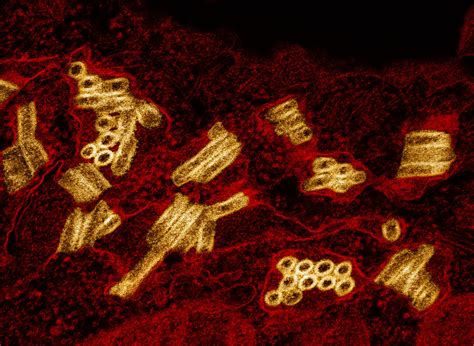 Rabies Virus Colorized Transmission Electron Micrograph Of Flickr