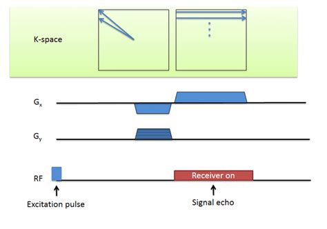 Acquisition Of Lines Of K Space With A Cartesian Sampling Scheme Download Scientific Diagram