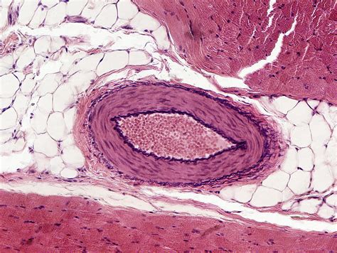 Elastic Artery Lm Photograph By Science Stock Photography Fine Art America