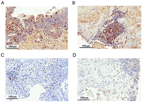 Representative Staining Patterns Of Cd8 Foxp3 And Cd69 Download Scientific Diagram