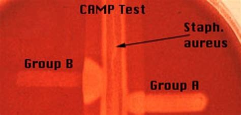 Micro Unit 2lecture 4 Under Construction Flashcards Quizlet