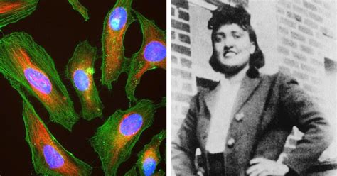 The Immortal Woman Henrietta Lacks And Hela Cells