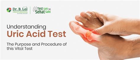 Uric Acid Test Purpose And Procedure Dr B Lal Lab