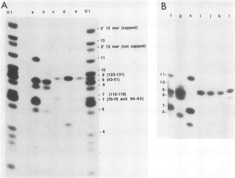 Rnase T1 Digestion Of Antibody Induced Nuclease Protected Ul Snrnp