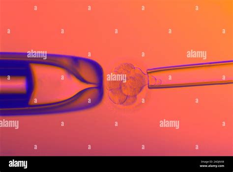 Ivf Embryo Testing Image 4 Of 5 Coloured Light Micrograph Of An Ivf Human Embryo During Pre