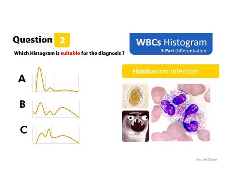 Wbc Histogram Pdf