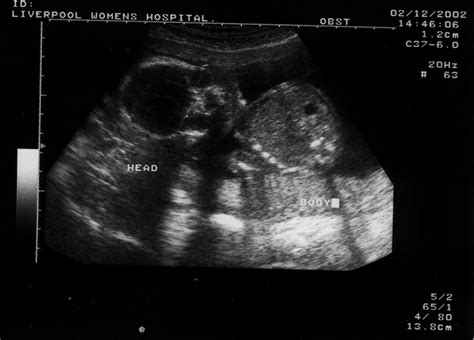 Vin W243b Simons Brother Or Sister 2 December 2002 