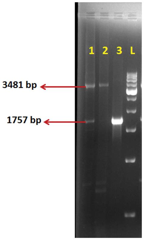 Genotyping Of Hp By Pcr The 3481 And 1757 Bp Pcr Products Marked By Download Scientific