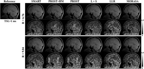 Reconstructed T 1ρ Weighted Images From One Slice Of The 3d Brain Download Scientific Diagram