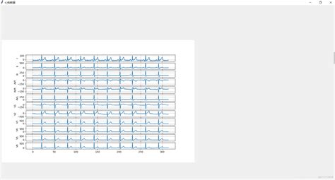 ecg python 处理 心跳信号 python心电图 jojo的技术博客 51cto博客