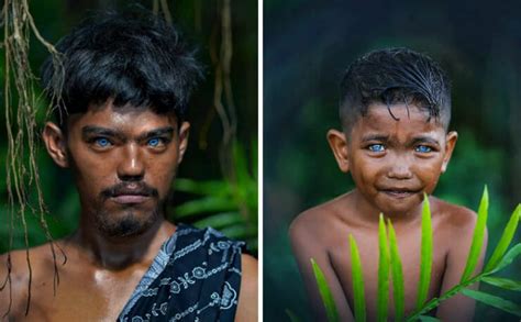 35 Individuals With Extremely Unusual Body Features Barnorama