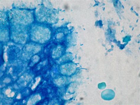 Giemsa Stain Helicobacter Pylori