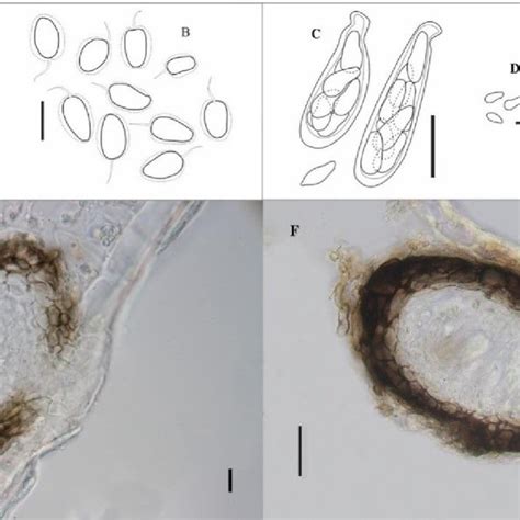 Phyllosticta Sp On Prunus Laurecerasus A Conidiogeneus Cell B