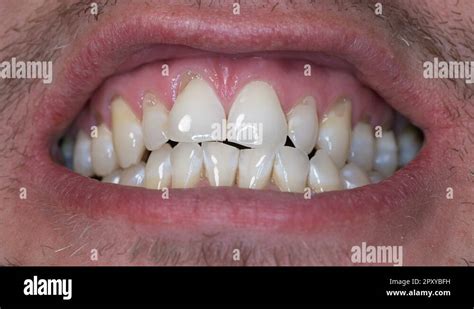 Man Grin Stock Videos And Footage Hd And 4k Video Clips Alamy