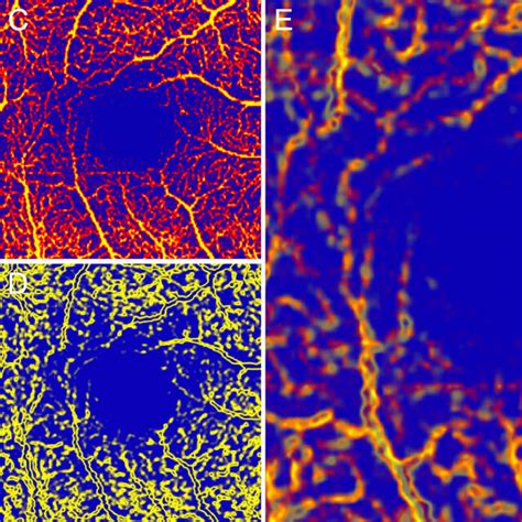 Hrhs Octa Overlapping Gap For Scpdcp Reconstruction Starting From