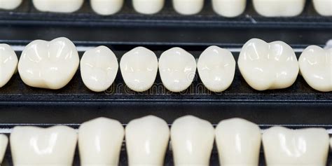 Dental Crowns And Prosthetic Teeth For Implants Stock Image Image Of