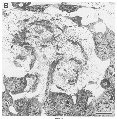 Figure 1 From Pathfinding By Neuronal Growth Cones In Grasshopper