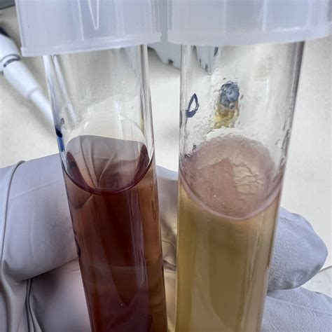 Usp Sterility Test Trustpointe Analytics Llc