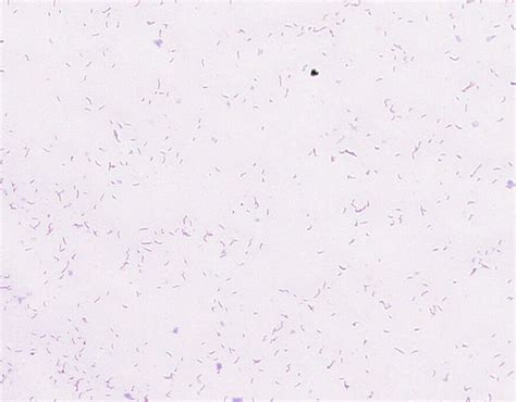 Lactobacillus Murinus Gmb2380 Gmbank