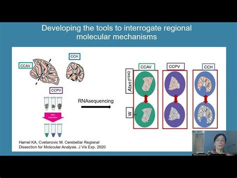Free Video Selective Neuronal Vulnerability In Neurodegeneration From