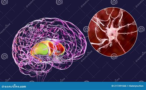 Corpus Striatum X Ray Profile Close Up View 3d Rendering Illustration With Body Contours Human