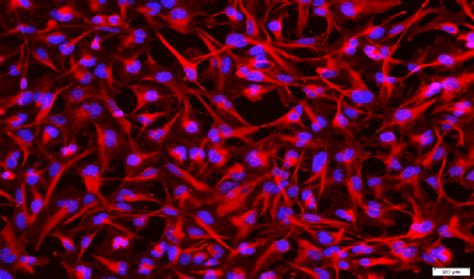 Ipsc Derived Human Neural Progenitor Cells With Media Cellsystems®