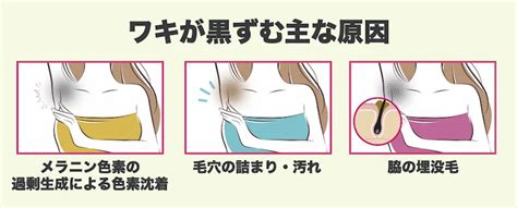 脇の黒ずみをとる方法は？市販の黒ずみ対策クリームから皮膚科の治療法まで！ 東中野皮フ科クリニック