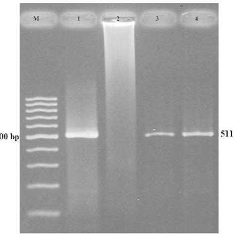 Gel Photograph Of The First Round Rt Pcr Product M 100 Bp Dna Ladder
