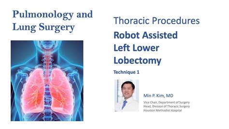 Robot Assisted Left Lower Lobectomy Technique 1 Youtube