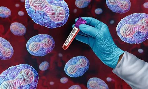 Deadly Sex Virus Cases Surge As Who Admits We Don T Know How Long This