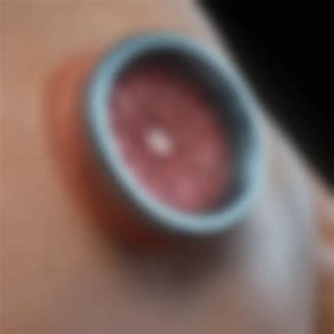 Understanding Cystoscopy A Detailed Exploration